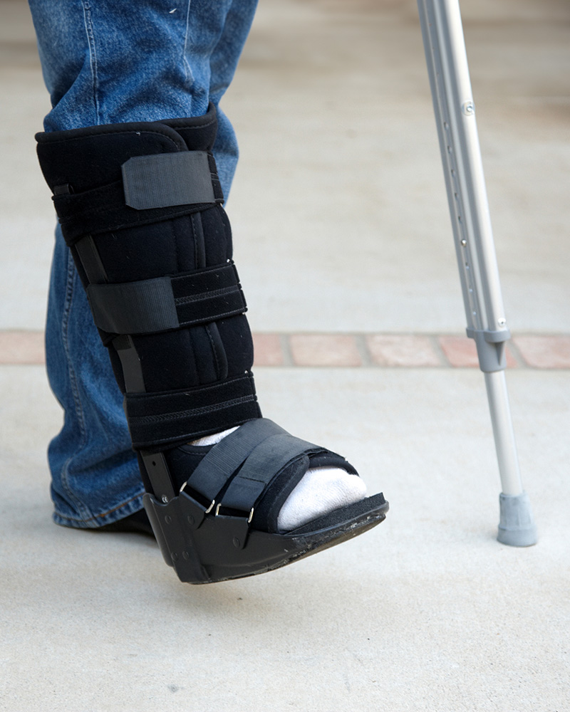 Suture Button Ankle Surgery I Orthopaedics I St Vincent’s Private Hospitals