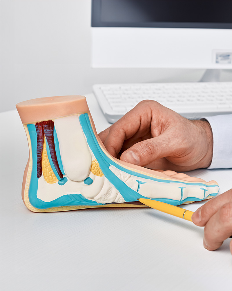 Flat Foot Surgery I Orthopaedics I St Vincent’s Private Hospitals