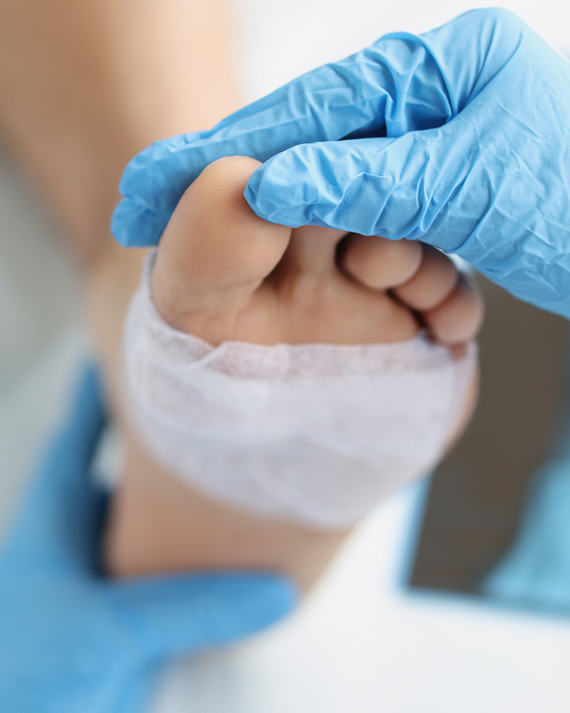 Neurectomy Foot Surgery I Orthopaedics I St Vincent’s Private Hospitals